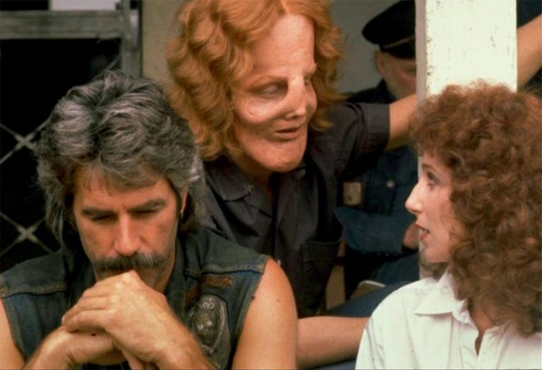 10 Heart-Rending Facts About Rocky Dennis, Whose Rare Deformity Was The ...