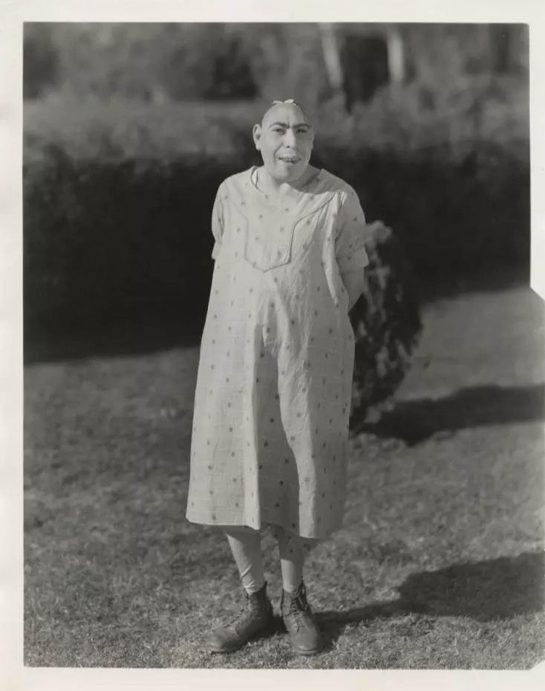 10 Heart-Rending Facts About Schlitzie, The Sideshow “Pinhead” Who Was ...