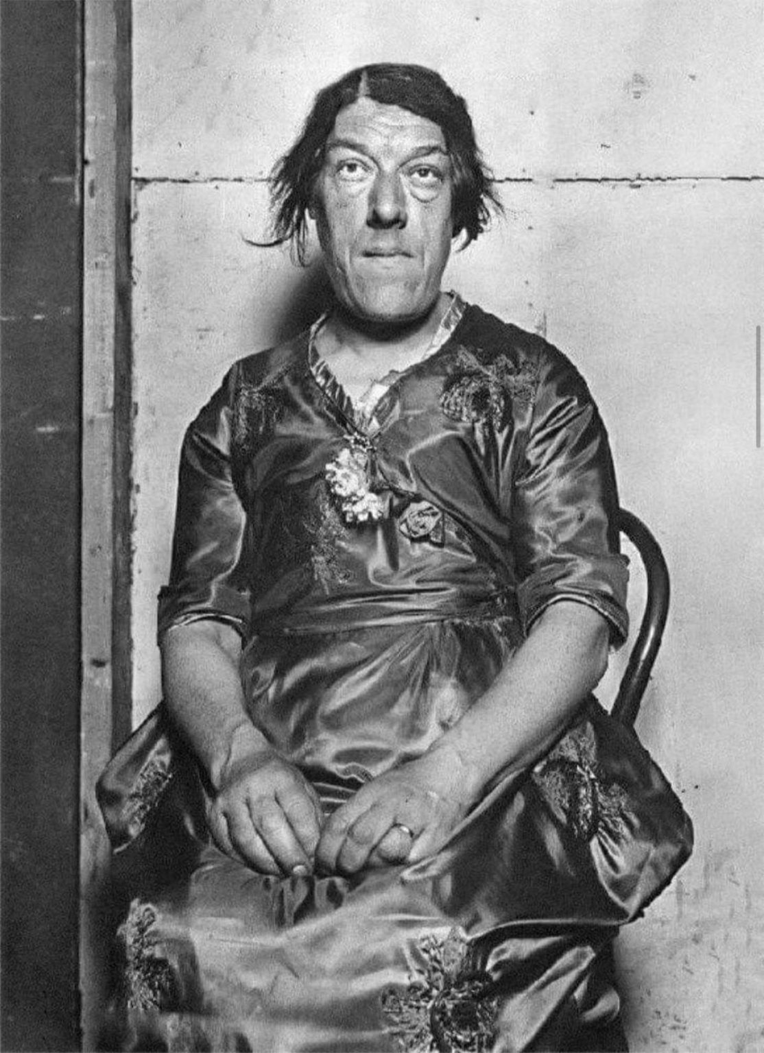 10 Tragic Details Surrounding Mary Ann Bevan, The “Ugliest Woman In The ...